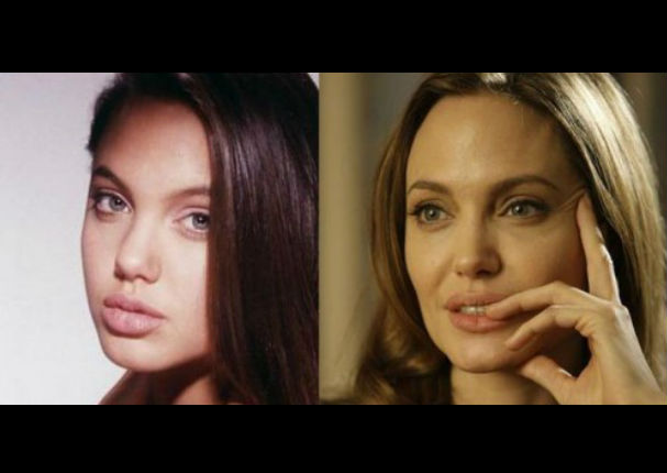 ¿te Diste Cuenta Angelina Jolie Se Operó El Rostro Hace Mucho Tiempo